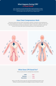 What If, After Four Minutes of Rescue Breathing, There's No Pulse?