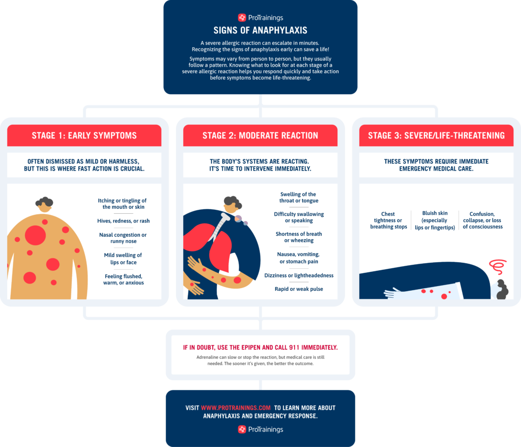 How to Use an EpiPen: Everything You Need to Know